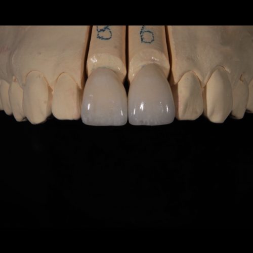 Smile gallery – VIP Dental care